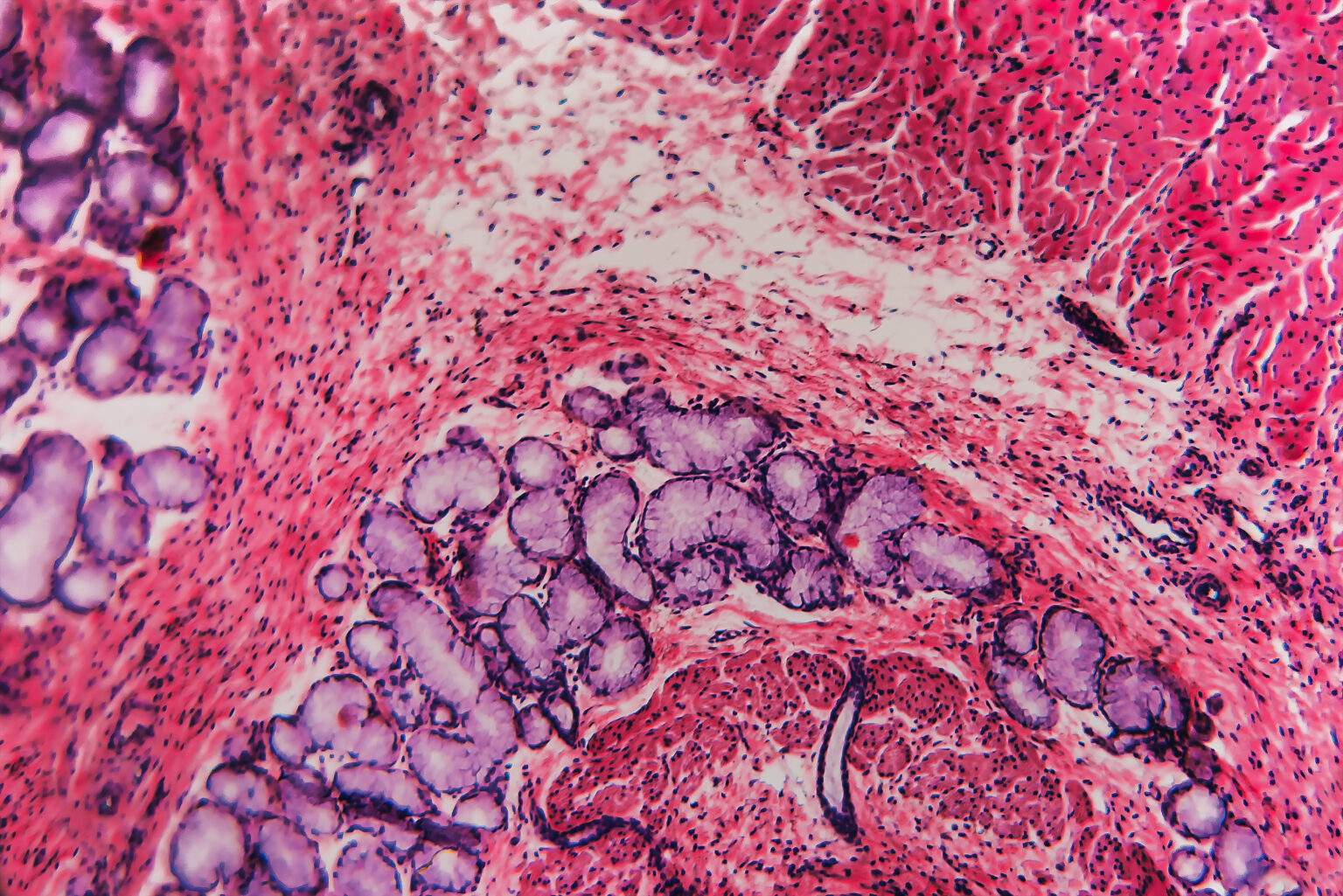 What Is Gastrointestinal Cancer in Canines: Types, Symptoms,